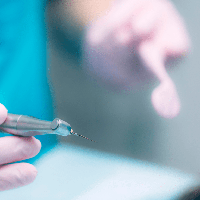 Signs and Symptoms: When to Seek a Root Canal Treatment